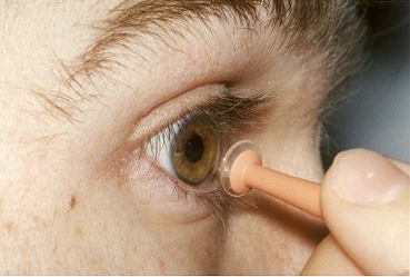 How to remove RGP Lens (AT229) – Dr Bird