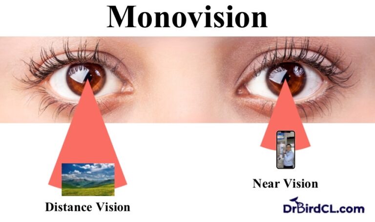 การจ่ายค่าสายตาแบบ Monovision คืออะไร ? แตกต่างจาก Multifocal อย่างไร ...
